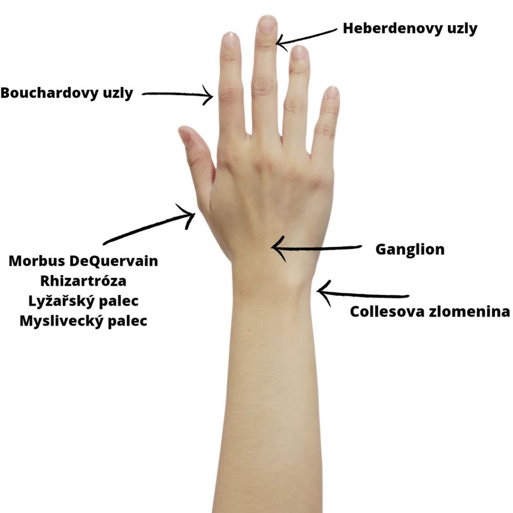 Nemocné kosti: příčiny, příznaky a léčba | Návod a rady - Červenec 2024 ...